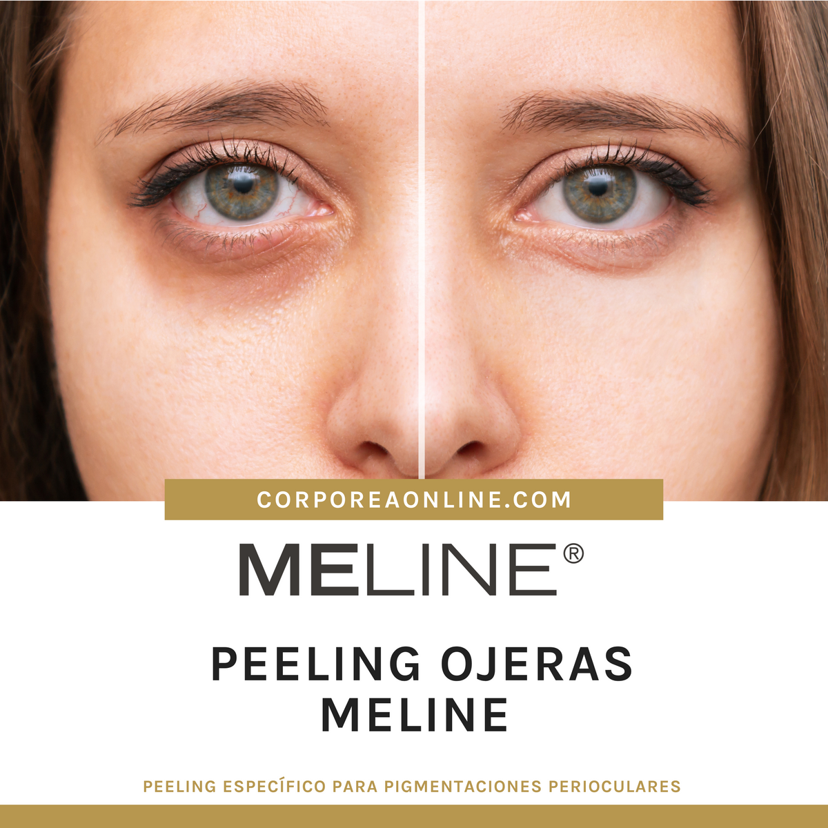 Peeling para ojeras DARK CIRCLES MELINE en Clínica Corpórea