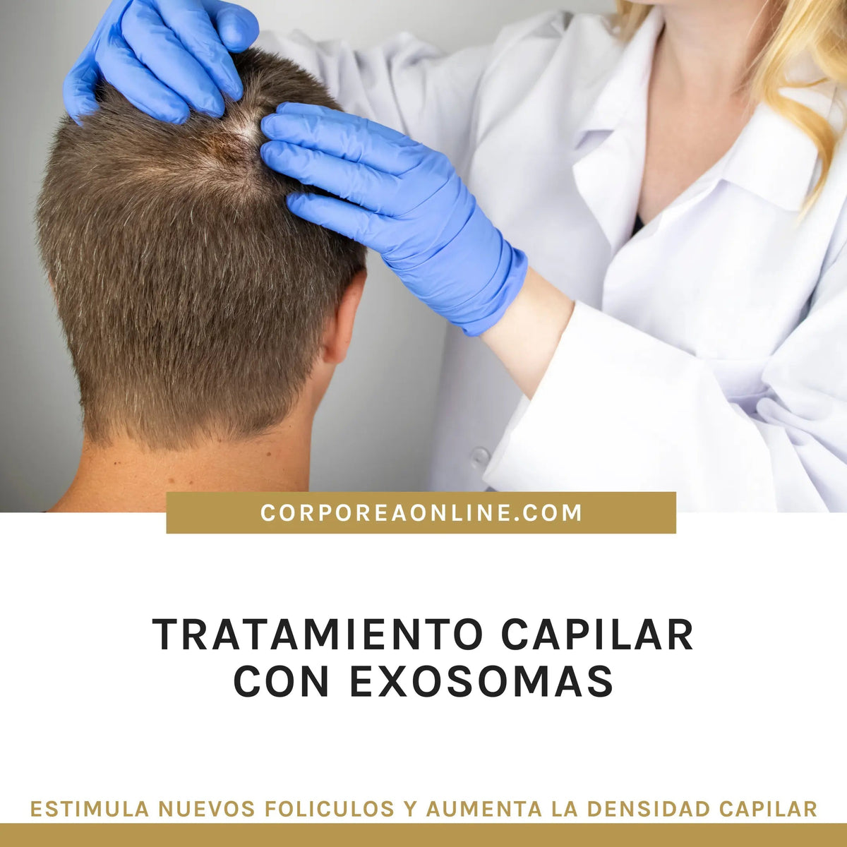 Tratamiento capilar con exosomas en Clínica Corpórea